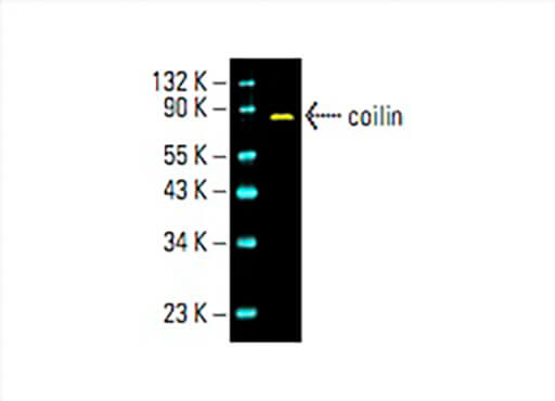 Anti-coilin Antibody (F-7) | SCBT - Santa Cruz Biotechnology