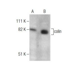 Anti-coilin Antibody (Pdelta) | SCBT - Santa Cruz Biotechnology