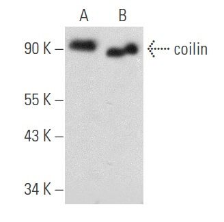 coilin Antibody (Pdelta) | SCBT - Santa Cruz Biotechnology