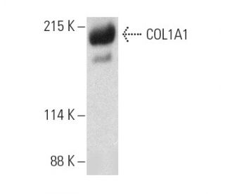 COL1A1 Antibody (3G3) - Western Blotting - Image 389125