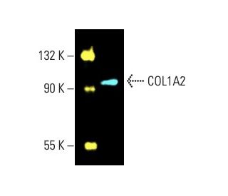 COL1A2 Antibody (E-6) - Western Blotting - Image 402173