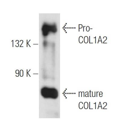 COL1A2 Antibody (G-4) | SCBT - Santa Cruz Biotechnology