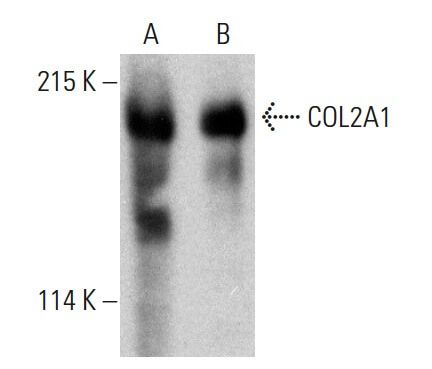 COL2A1 Antibody (B-1) | SCBT - Santa Cruz Biotechnology