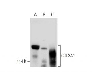 COL3A1 Antibody (B-10) - Western Blotting - Image 324805