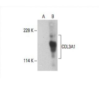 COL3A1 Antibody (B-10) - Western Blotting - Image 393549