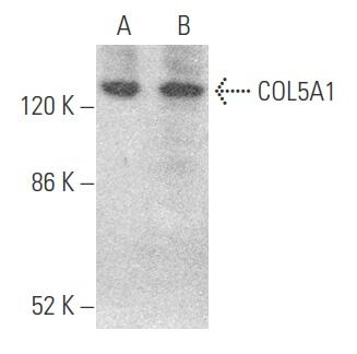 COL5A1 Antibody (E-8) | SCBT - Santa Cruz Biotechnology