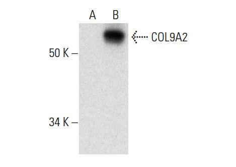 COL9A2 Antibody (H-8) | SCBT - Santa Cruz Biotechnology