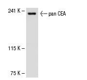 COLO 320DM Cell Lysate | SCBT - Santa Cruz Biotechnology