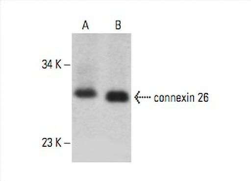 connexin 26 Antibody (P1F5) | SCBT - Santa Cruz Biotechnology