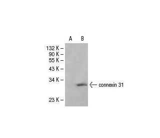 connexin 31 Antibody (LL8) | SCBT - Santa Cruz Biotechnology