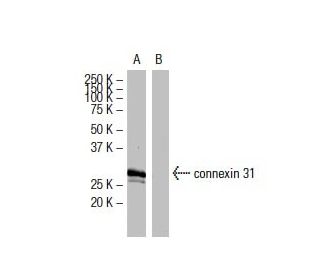 connexin 31 Antibody (LL8) | SCBT - Santa Cruz Biotechnology