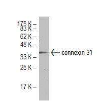 connexin 31 Antibody (LL8) | SCBT - Santa Cruz Biotechnology