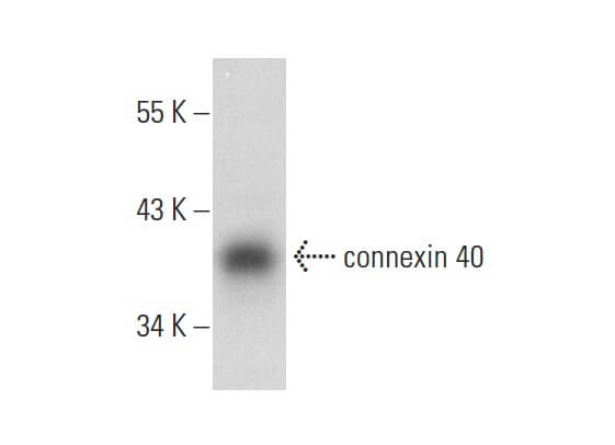 connexin 40 Antibody (B-3) | SCBT - Santa Cruz Biotechnology