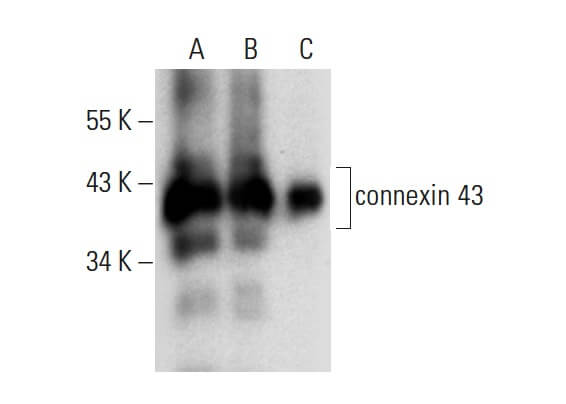 connexin 43 Antibody (F-7) | SCBT - Santa Cruz Biotechnology
