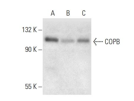 COPB Antibody (C-11) | SCBT - Santa Cruz Biotechnology