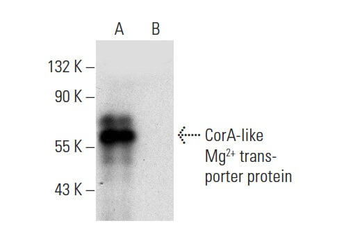 CorA-like Mg2+ transporter protein Antibody (A-9) | SCBT - Santa Cruz ...