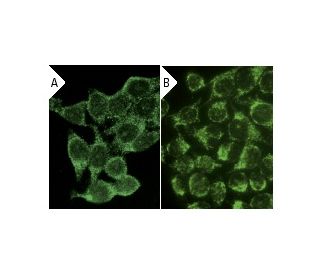 Anti-cPLA2 Antibody (4-4B-3C) | SCBT - Santa Cruz Biotechnology