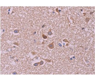 CPT1-C Antibody (B-1) - Immunohistochemistry - Image 387433