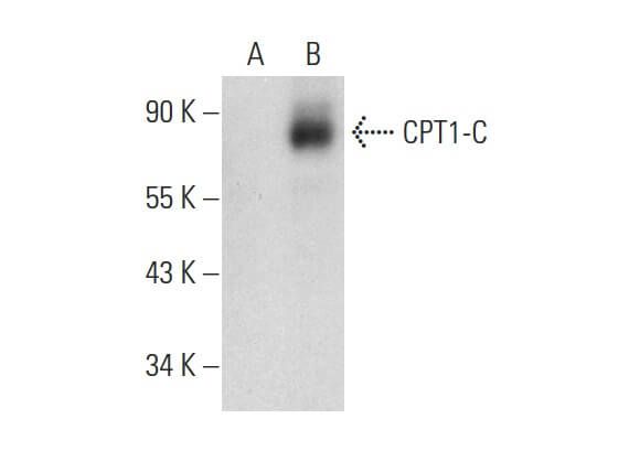CPT1-C Antibody (B-1) | SCBT - Santa Cruz Biotechnology