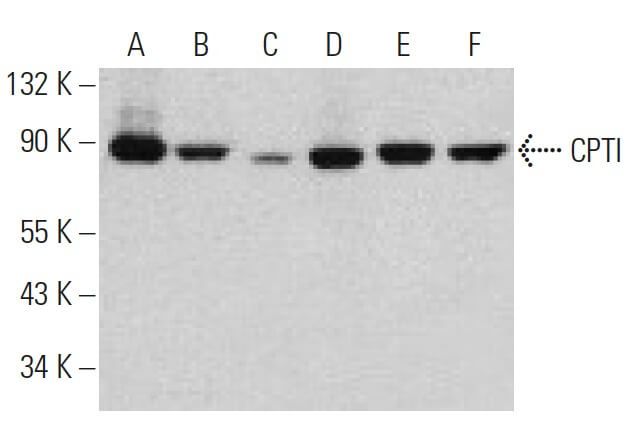 CPTI Antibody (E-7) | SCBT - Santa Cruz Biotechnology