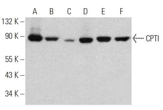 Anti-CPTI Antibody (E-7) | SCBT - Santa Cruz Biotechnology