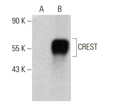 Anti-CREST Antibody (D-7) | SCBT - Santa Cruz Biotechnology