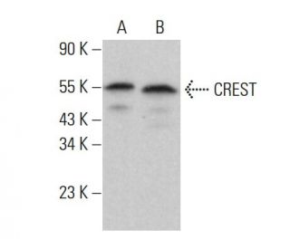 CREST Antibody (D-7) - Western Blotting - Image 383796