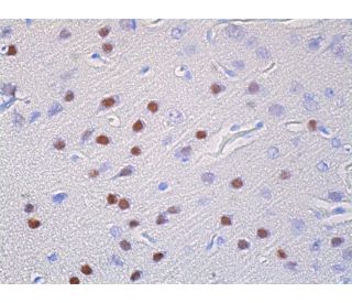 CREST Antibody (G-8) | SCBT - Santa Cruz Biotechnology