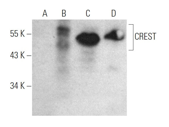 CREST Antibody (G-8) | SCBT - Santa Cruz Biotechnology