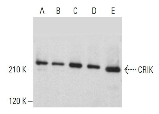 CRIK Antibody (E-6) | SCBT - Santa Cruz Biotechnology