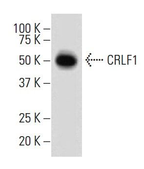 CRLF1 Antibody (QQ9) | SCBT - Santa Cruz Biotechnology
