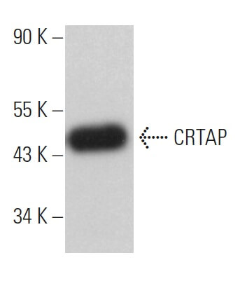 CRTAP Antibody (E-1) | SCBT - Santa Cruz Biotechnology