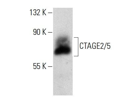 CTAGE2/5 Antibody (B-1) | SCBT - Santa Cruz Biotechnology