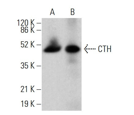CTH Antibody (A-2) | SCBT - Santa Cruz Biotechnology