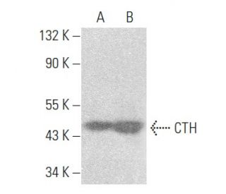 Anti-CTH Antibody (F-1) | SCBT - Santa Cruz Biotechnology