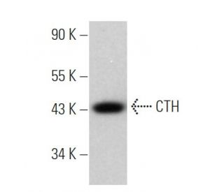Anti-CTH Antibody (F-1) | SCBT - Santa Cruz Biotechnology