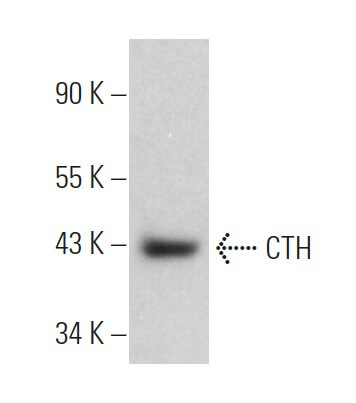 Anti-CTH Antibody (F-1) | SCBT - Santa Cruz Biotechnology