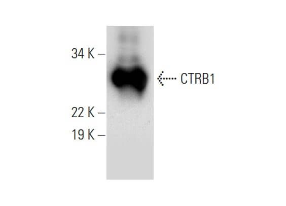 CTRB1/2 Antibody (D-5) | SCBT - Santa Cruz Biotechnology