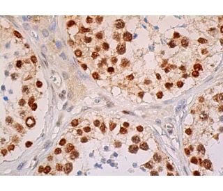 Anti-CUG-BP1 Antibody (3B1) | SCBT - Santa Cruz Biotechnology