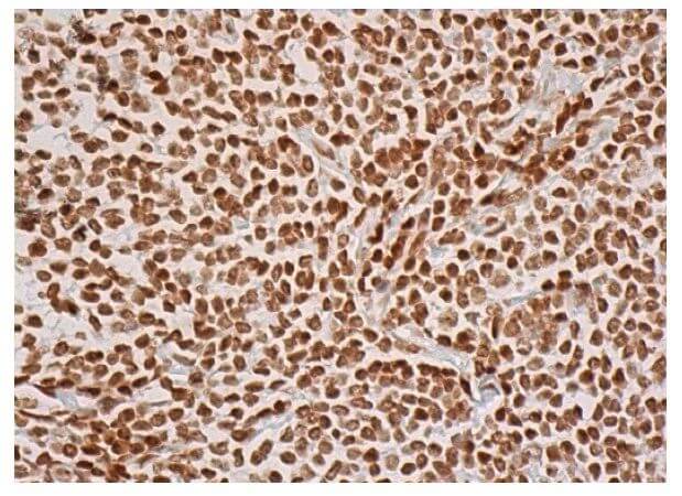 cyclin A Antibody (B-8) | SCBT - Santa Cruz Biotechnology