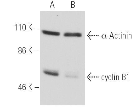 CCNB1/cyclin B1 siRNA (h), shRNA 와 Lentiviral Particle Gene Silencers ...