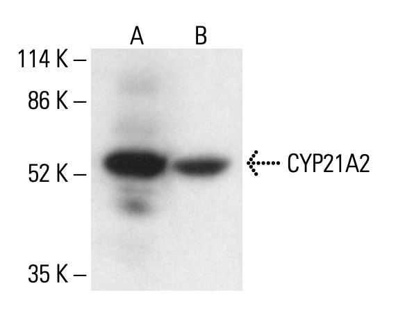 CYP21A2 Antibody (B-7) | SCBT - Santa Cruz Biotechnology