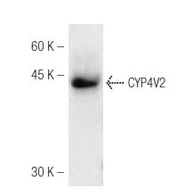 Anti-CYP4V2 Antibody (M29-P3B10) | SCBT - Santa Cruz Biotechnology