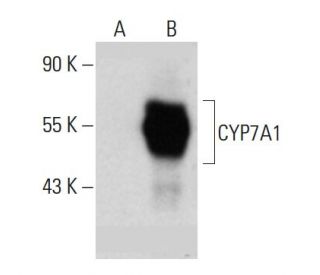 CYP7A1 Antibody (E-10) - Western Blotting - Image 385348
