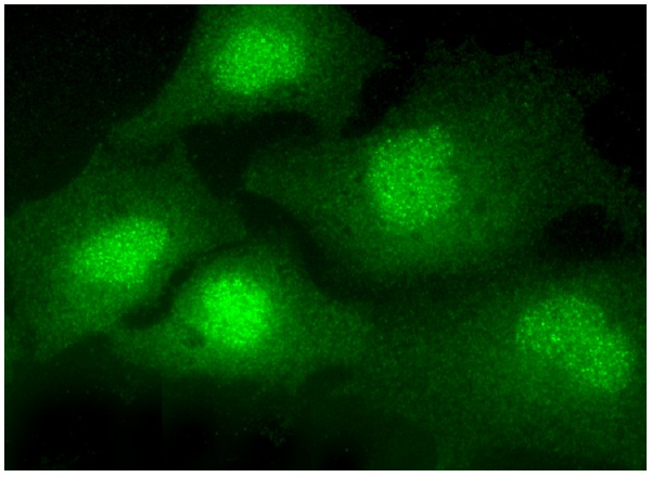 cystatin B Antibody (F-5) | SCBT - Santa Cruz Biotechnology