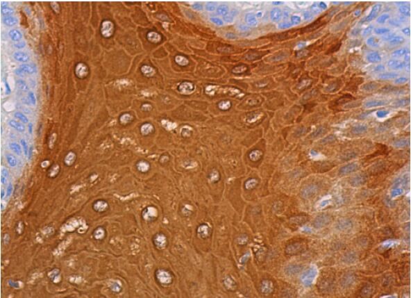 cystatin B Antibody (F-5) | SCBT - Santa Cruz Biotechnology