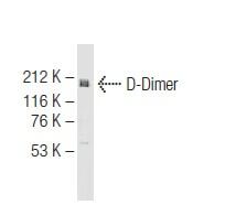 D-Dimer Antibody (DD1) | SCBT - Santa Cruz Biotechnology