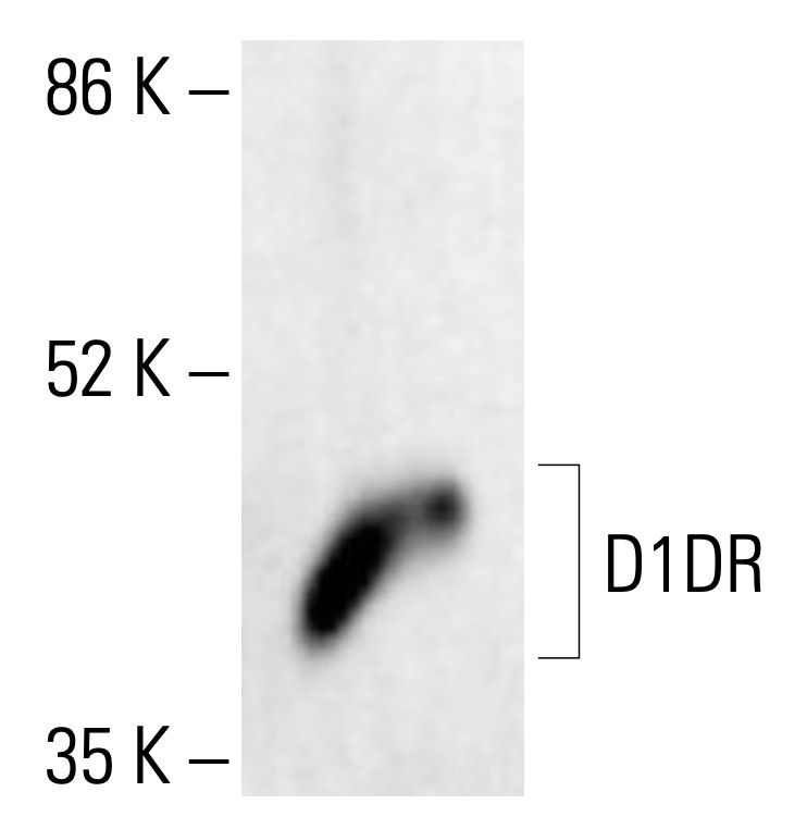 D1DR/Dopamine Receptor D1 Antibody (A-1) | SCBT - Santa Cruz Biotechnology