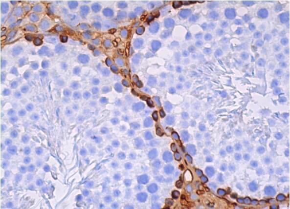 Anti-D3DR Antibody (9F4) | SCBT - Santa Cruz Biotechnology