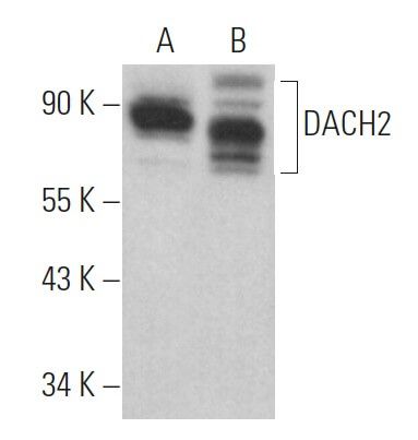 DACH2 Antibody (A-5) | SCBT - Santa Cruz Biotechnology